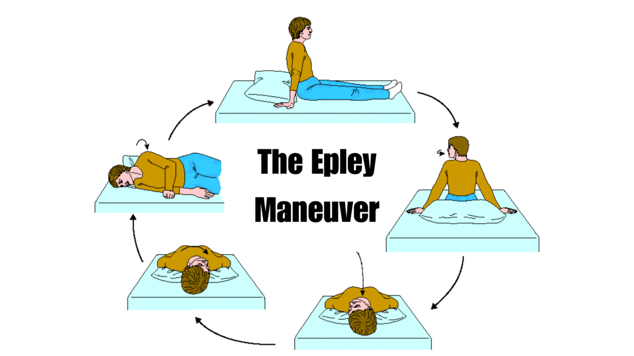 The Epley Maneuver Explained: Simple Steps for Vertigo Relief